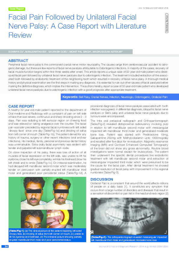 (PDF) Facial pain followed by unilateral facial nerve palsy: a case ...