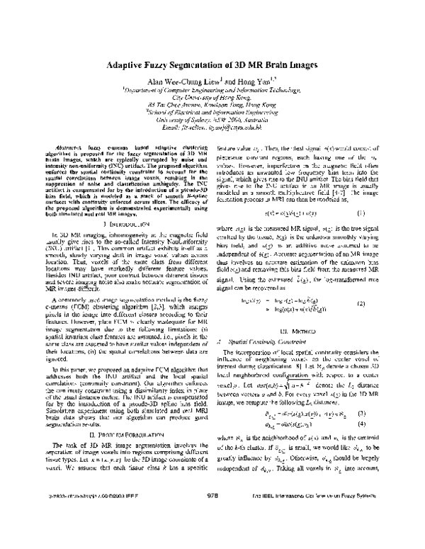 (PDF) Adaptive fuzzy segmentation of 3D MR brain images