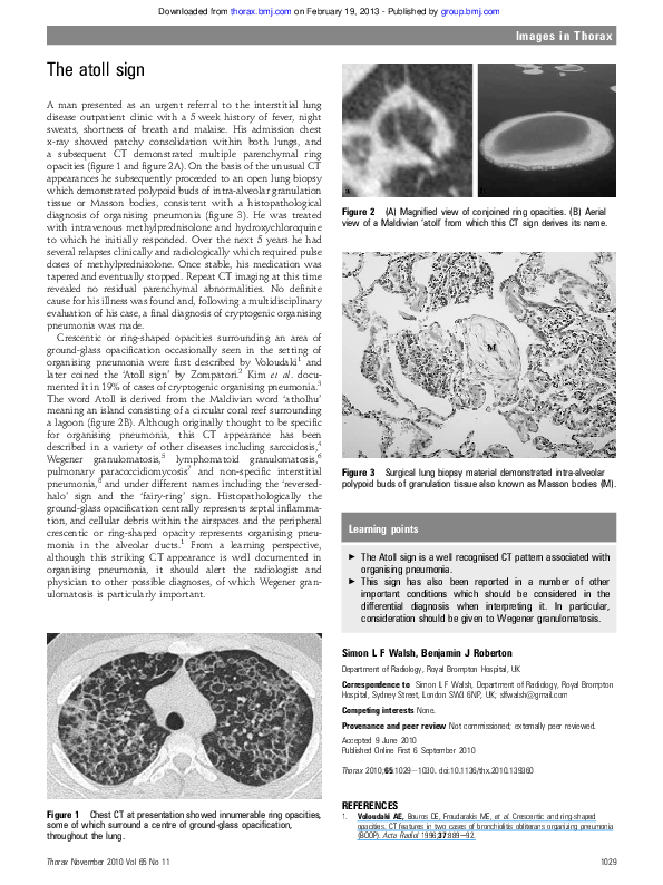 (PDF) The atoll sign