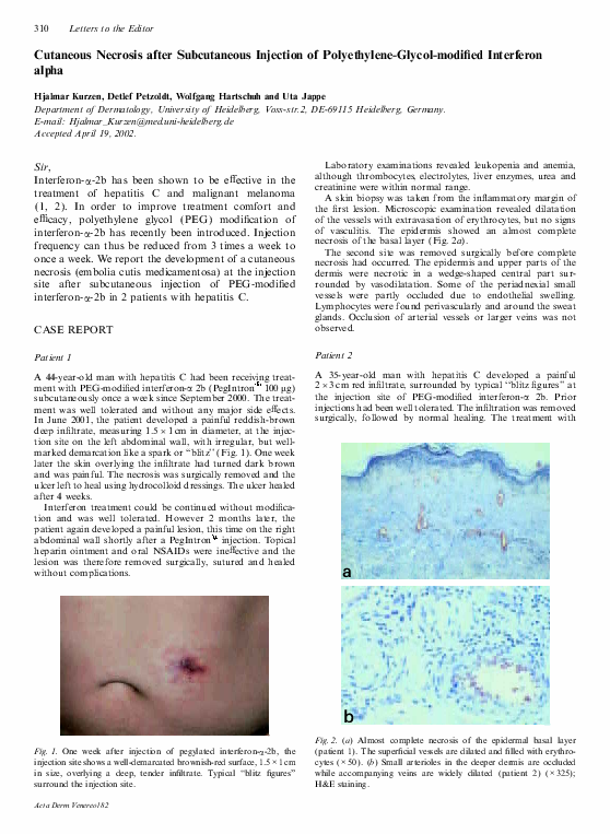 (PDF) Cutaneous Necrosis after Subcutaneous Injection of Polyethylene ...