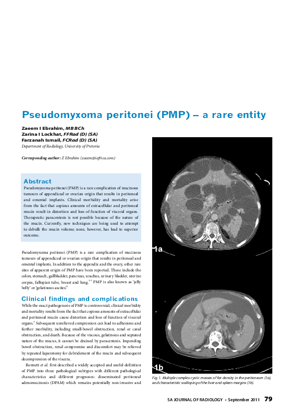 (PDF) Pseudomyxoma peritonei (PMP) - a rare entity