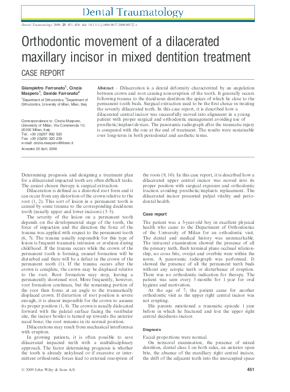 (PDF) Orthodontic movement of a dilacerated maxillary incisor in mixed ...