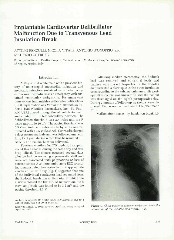 (PDF) Implantable Cardioverter Defibrillator Malfunction Due to ...