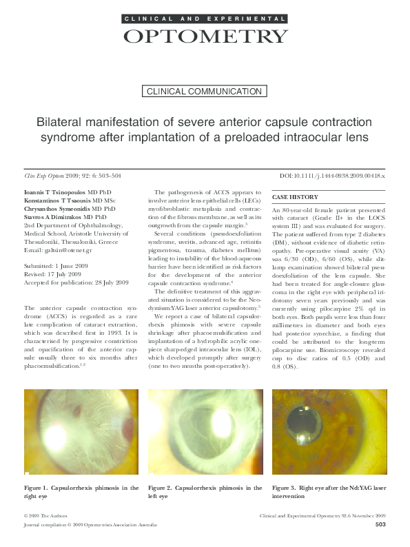(PDF) Bilateral manifestation of severe anterior capsule contraction ...
