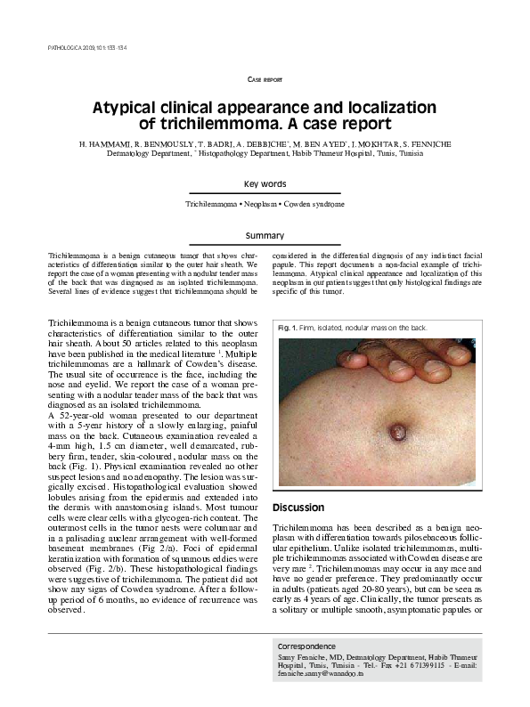 (PDF) Atypical clinical appearance and localization of trichilemmoma. a ...