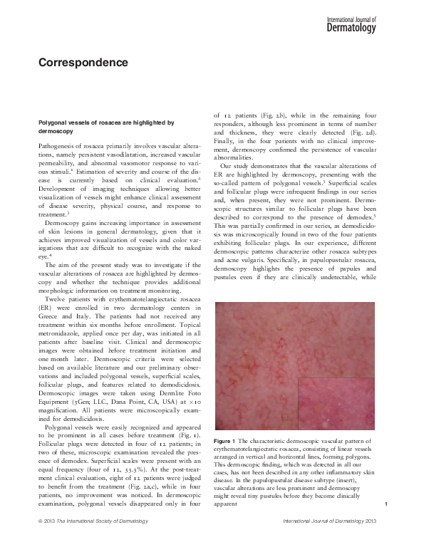 (PDF) Polygonal vessels of rosacea are highlighted by dermoscopy