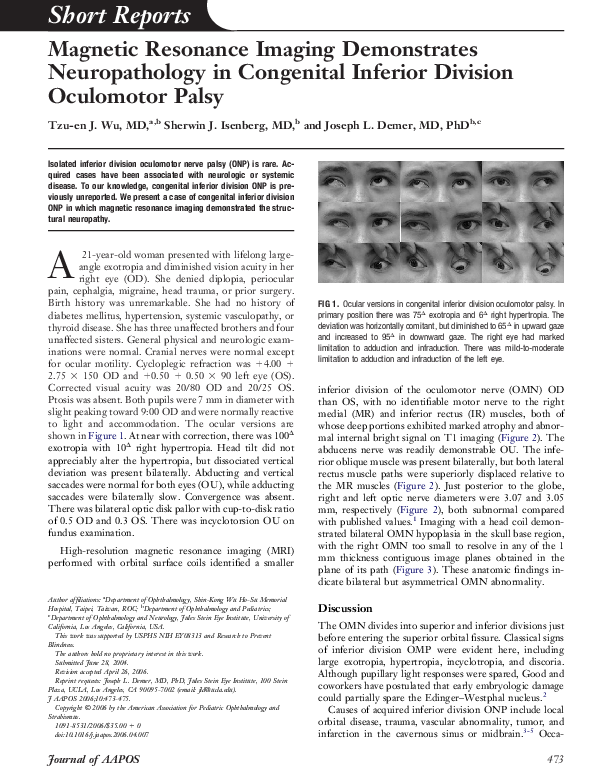 (PDF) Congenital Ocular Neuromyotonia with Partial Third Nerve Palsy ...