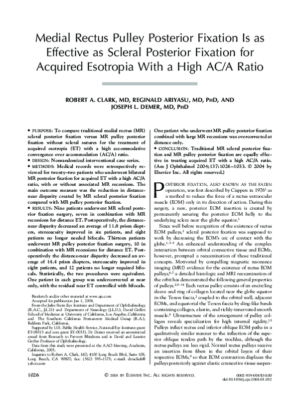 (PDF) Medial rectus pulley posterior fixation is as effective as ...
