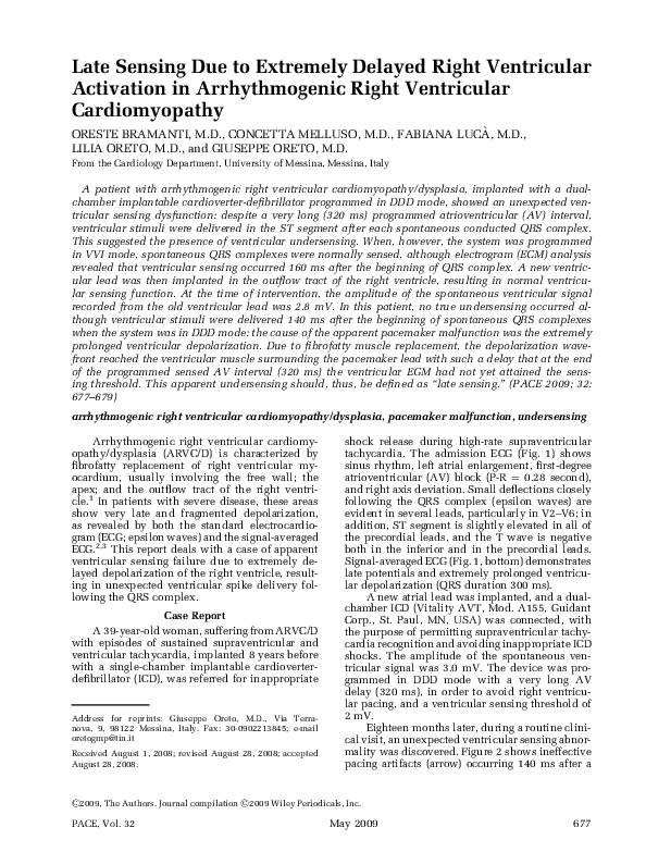 (PDF) Late Sensing Due to Extremely Delayed Right Ventricular ...