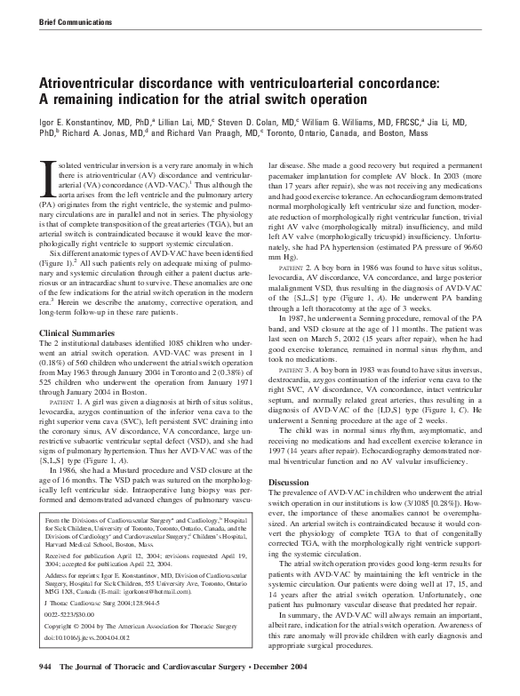 (PDF) Atrioventricular discordance with ventriculoarterial concordance ...