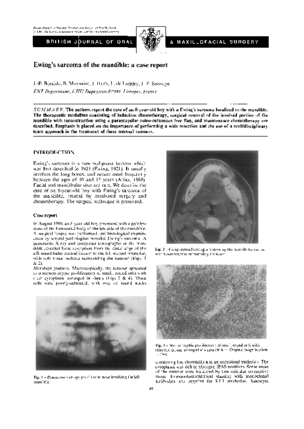 (PDF) Ewing´s sarcoma of the mandible. A case report