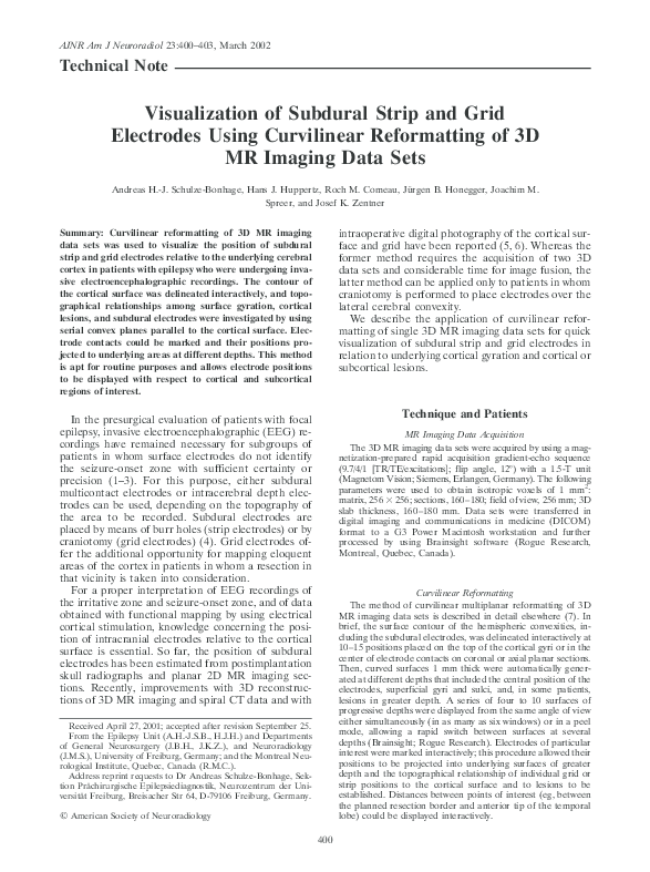 (PDF) Visualization of subdural strip and grid electrodes using curvilinear reformatting of 3D ...