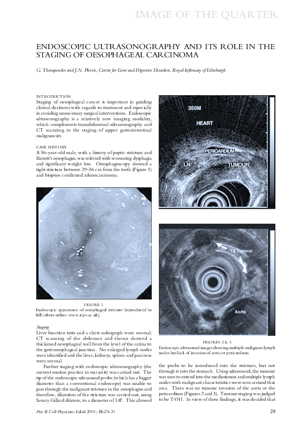 (PDF) Trans-Endoscopic Ultrasonography of the Oesophagus and ...