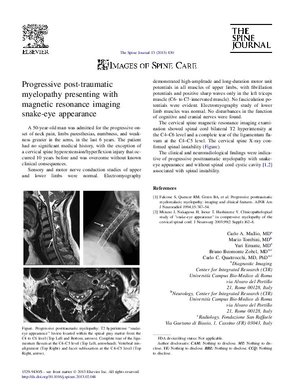 (PDF) Progressive post-traumatic myelopathy presenting with magnetic ...