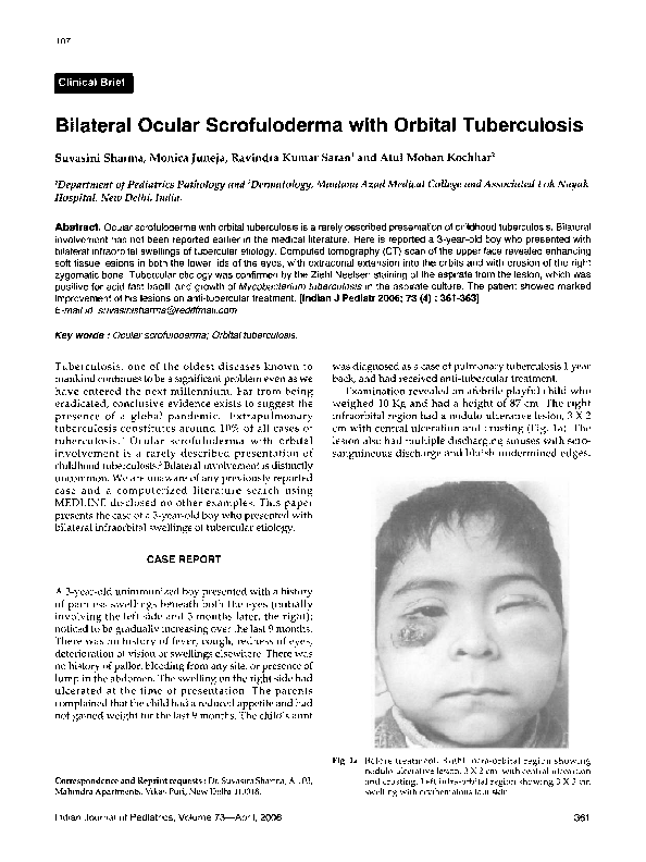(PDF) Bilateral ocular scrofuloderma with orbital tuberculosis