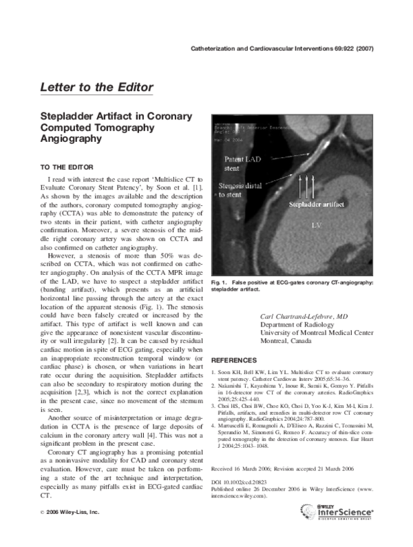 (PDF) Stepladder artifact in coronary computed tomography angiography