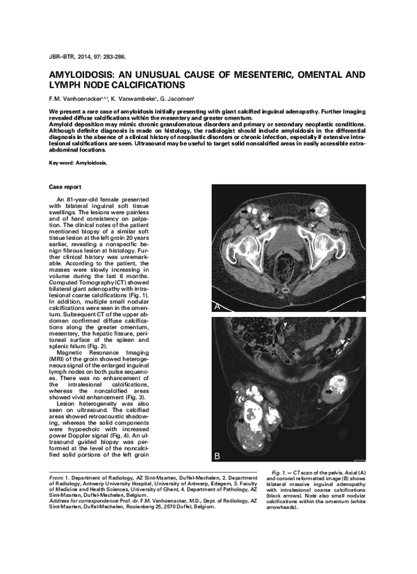 (PDF) Amyloidosis: an unusual cause of mesenteric, omental and lymph ...