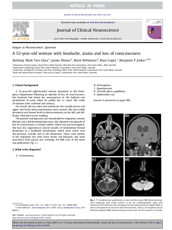(PDF) A 52-year-old woman with headache, ataxia and loss of ...