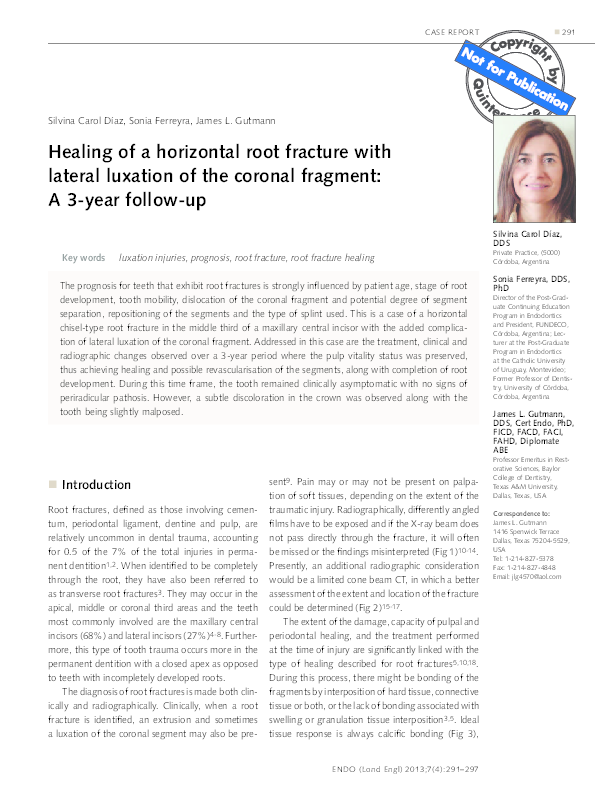 (PDF) Resective Procedure in the Management of Maxillary Molar with ...