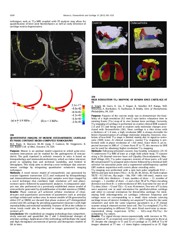 (PDF) High resolution T1ρ mapping of human knee cartilage at 7T