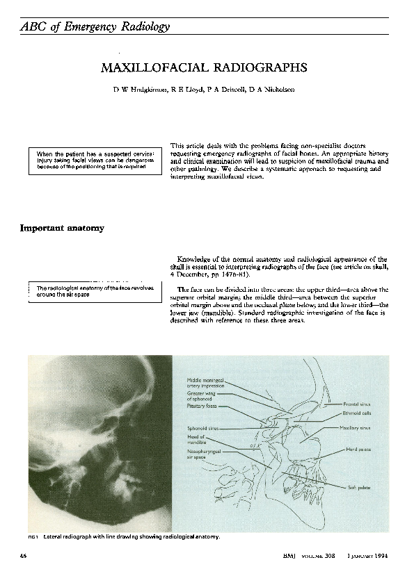 (PDF) ABC of Emergency Radiology MAXILLOFACIAL RADIOGRAPHS