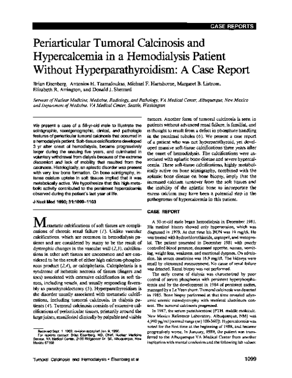 Pdf Sclerochoroidal Calcifications Case Presentation And Review Case Report Hardik Parikh