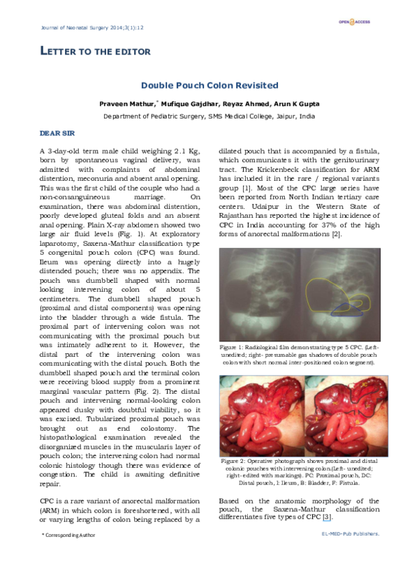 (PDF) Double pouch colon revisited