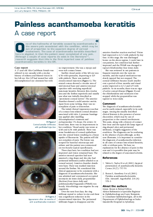 (PDF) Painless Acanthamoeba keratitis