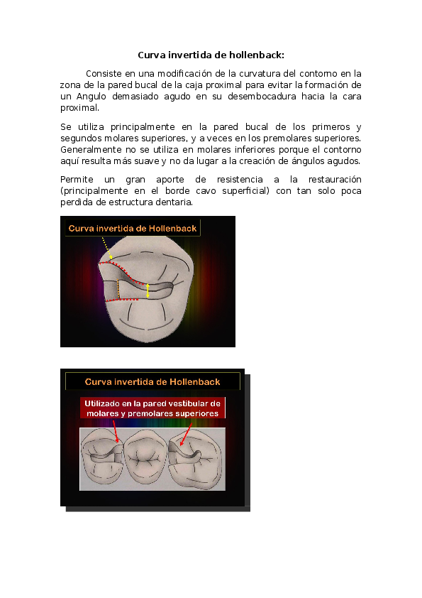 (DOC) Curva invertida de hollenback