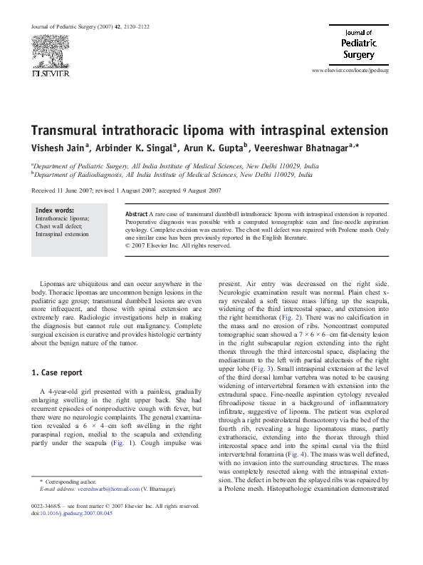 (PDF) Transmural intrathoracic lipoma with intraspinal extension