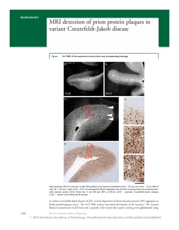 (PDF) MRI detection of prion protein plaques in variant Creutzfeldt ...
