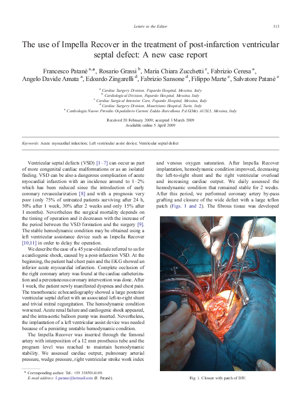 (PDF) The use of Impella Recover in the treatment of post-infarction ...