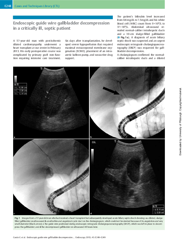 (PDF) Endoscopic guide wire gallbladder decompression in a critically ...