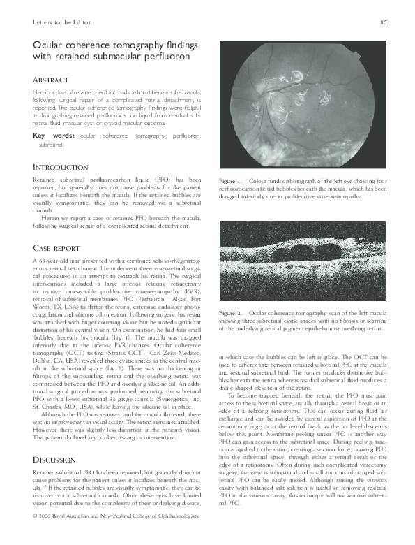 (PDF) Ocular coherence tomography findings with retained submacular ...