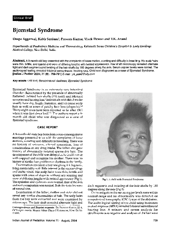 (PDF) Bjornstad syndrome