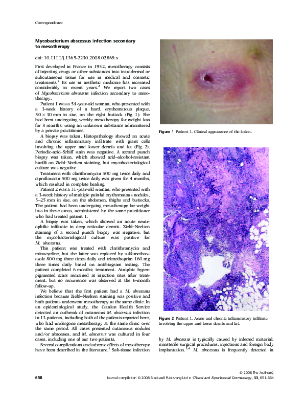 (PDF) Mycobacterium abscessus infection secondary to mesotherapy