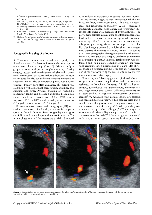 (PDF) Sonographic imaging of urinoma