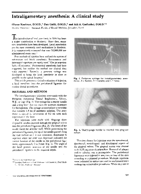(PDF) Intraligamentary anesthesia: A clinical study