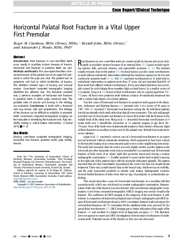 (PDF) Horizontal Palatal Root Fracture in a Vital Upper First Premolar