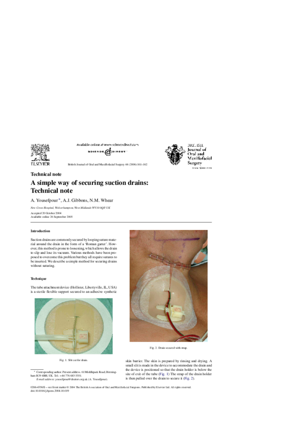 (PDF) A simple way of securing suction drains: Technical note