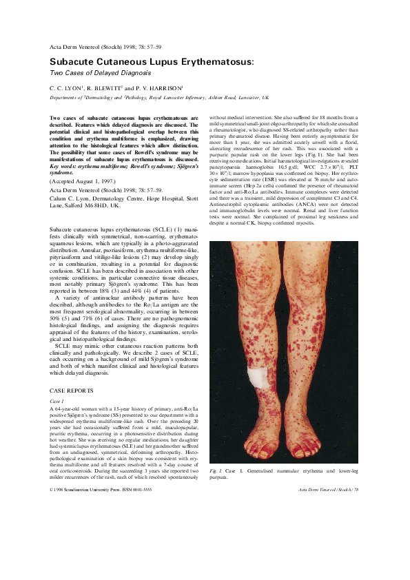 Pdf Subacute Cutaneous Lupus Erythematosus Clinical Serologic