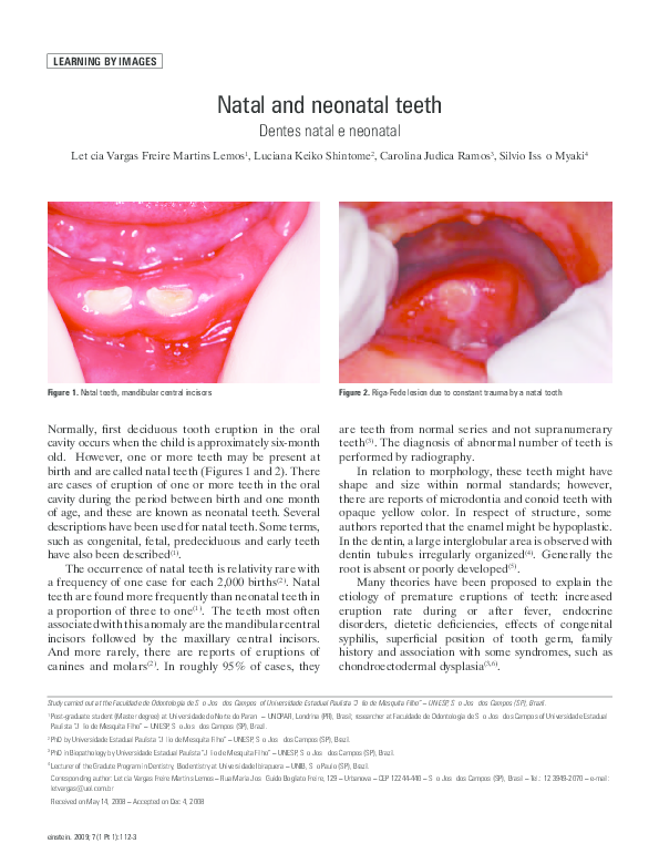 (PDF) Natal and neonatal teeth