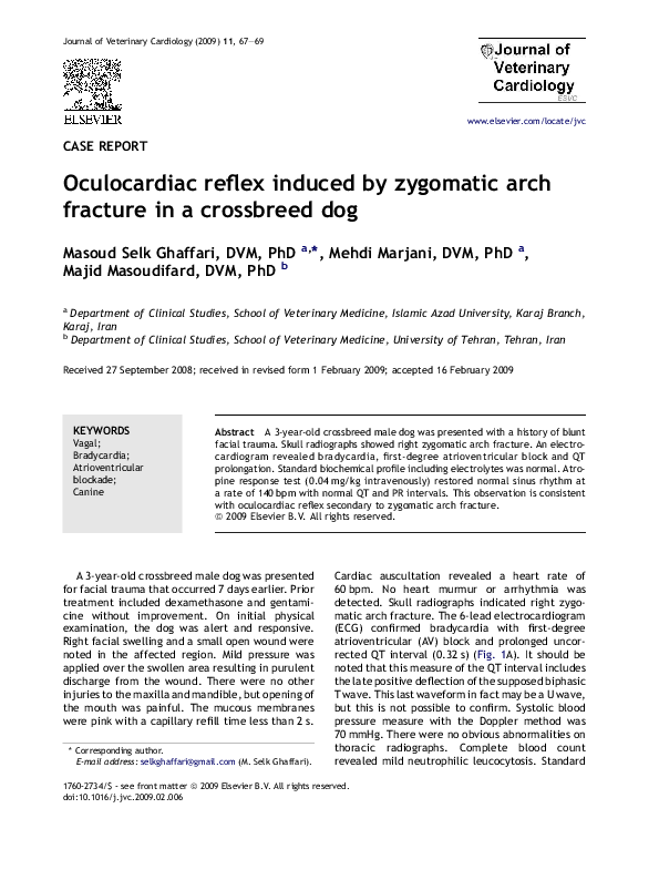 (PDF) Oculocardiac reflex induced by zygomatic arch fracture in a ...