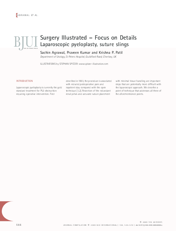 (PDF) Laparoscopic pyeloplasty, suture slings
