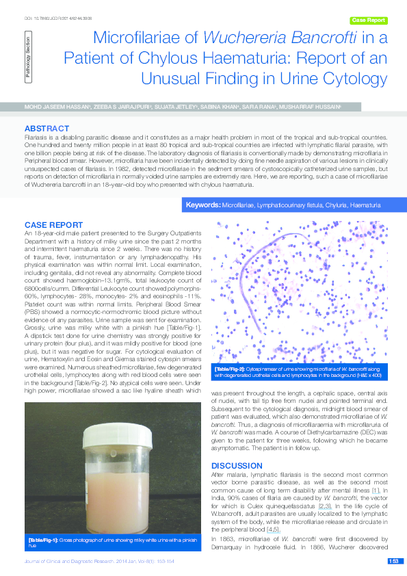 (PDF) Microfilariae of Wuchereria Bancrofti in a Patient of Chylous ...