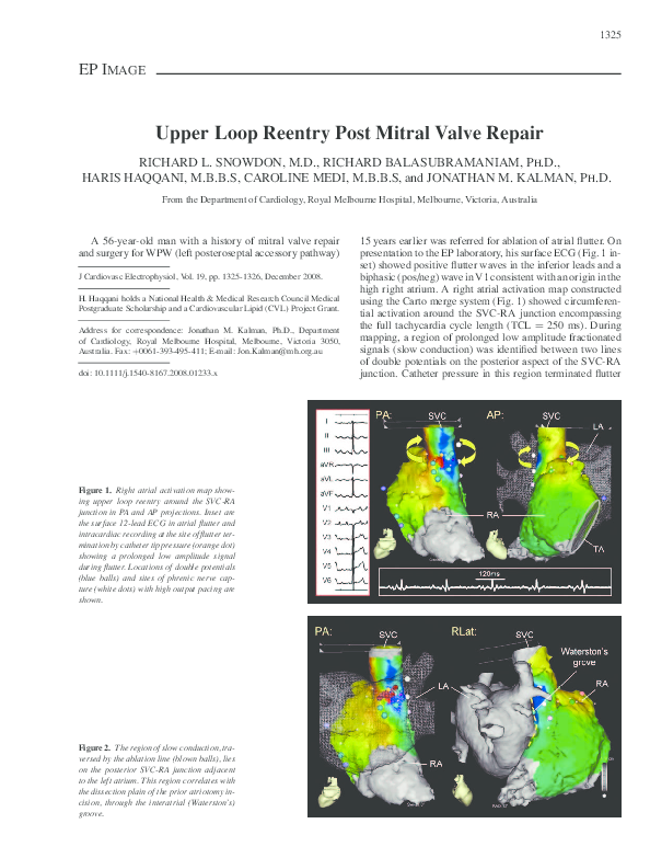 (PDF) Upper Loop Reentry Post Mitral Valve Repair