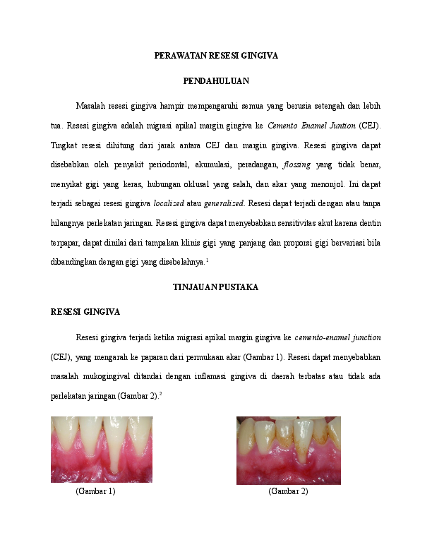 (DOC) PERAWATAN RESESI GINGIVA