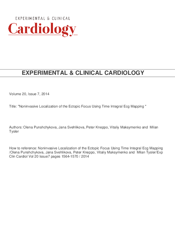 (PDF) Noninvasive Localization of the Ectopic Focus Using Time Integral ...