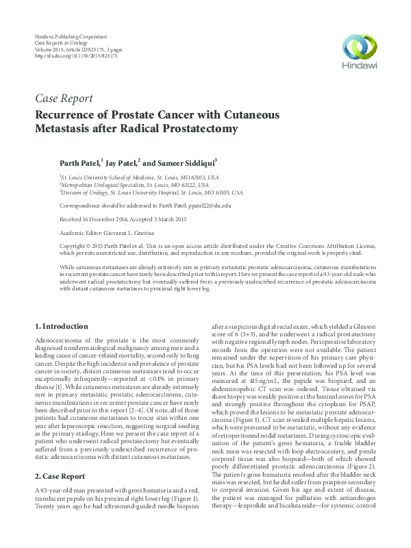 (PDF) Recurrence of Prostate Cancer with Cutaneous Metastasis after ...