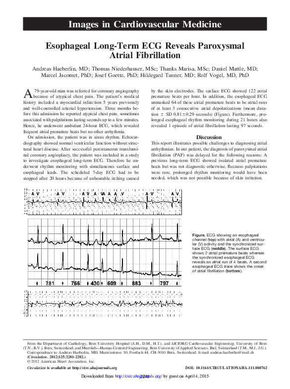 (PDF) Esophageal Long-Term ECG Reveals Paroxysmal Atrial Fibrillation ...